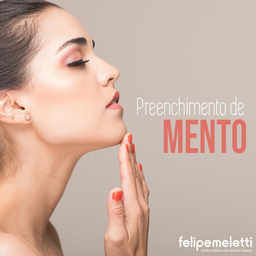 Preenchimento de mento - Clínica Felipe Meletti